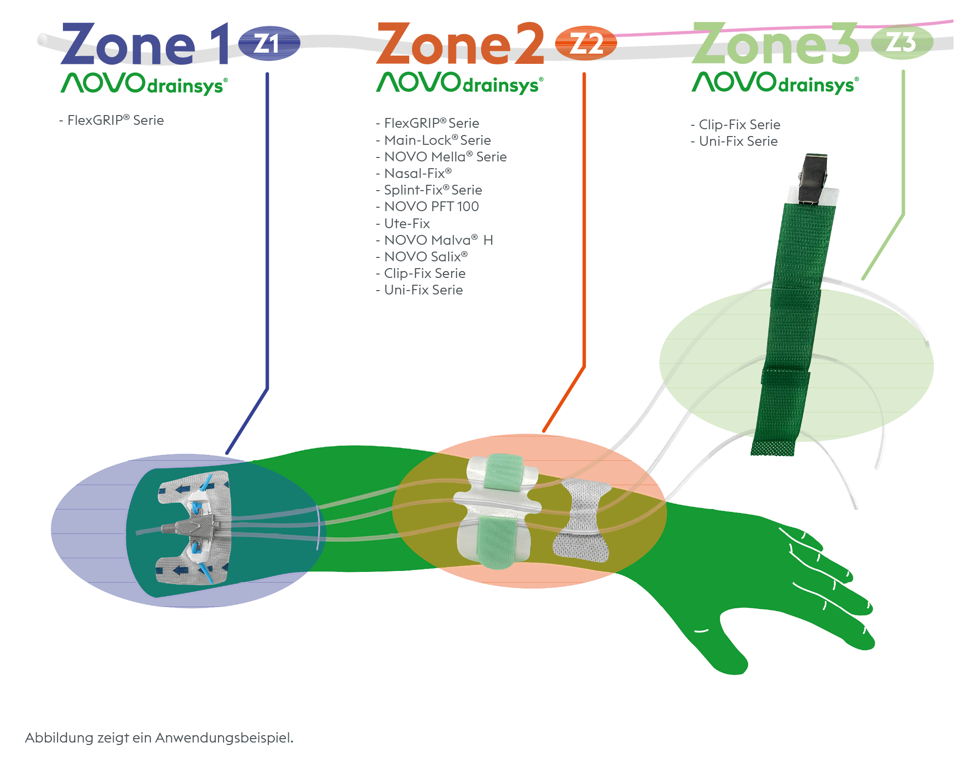 Nasal-Fix - NOVO Fixierung für Sonden
