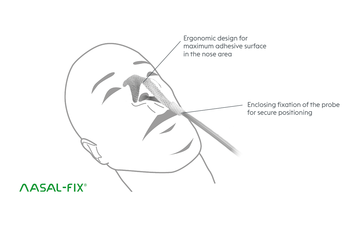 Nasal-Fix - NOVO fixation for probes